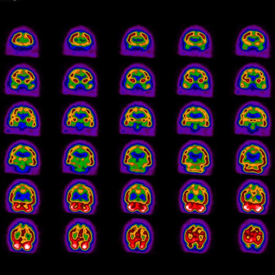 SPECT - Dra. Cristina Matushita